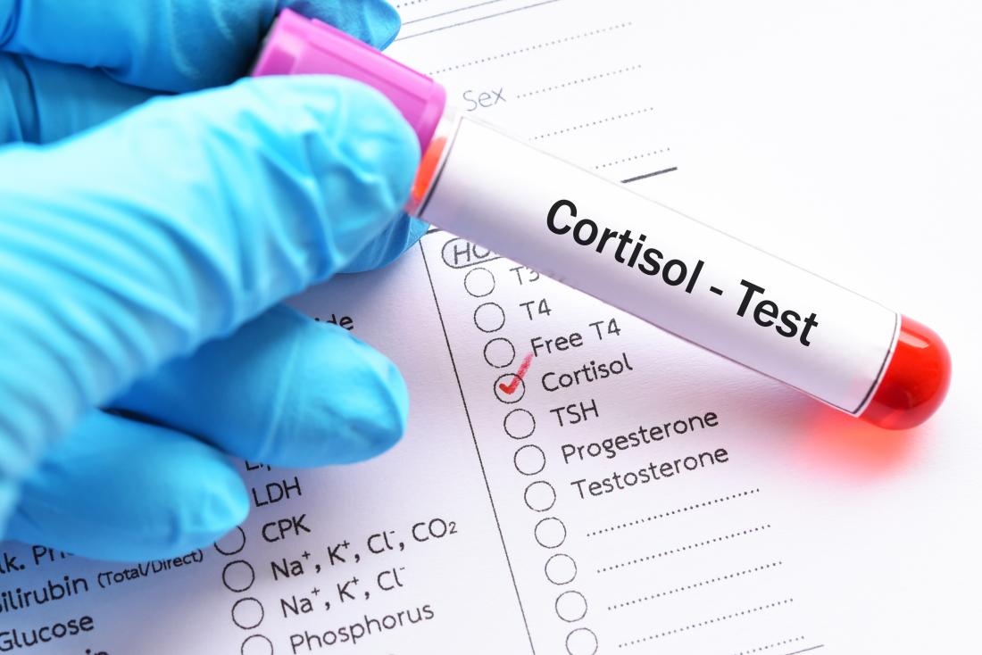 Cortisol Test: Meet Je Stressniveaus Eenvoudig